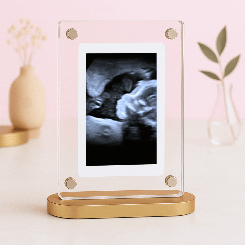LoopFrame™ - Baby Video Frame – Loop Hive